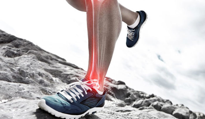 Cause for Shin Splints, Explanations, and Treatment Advice